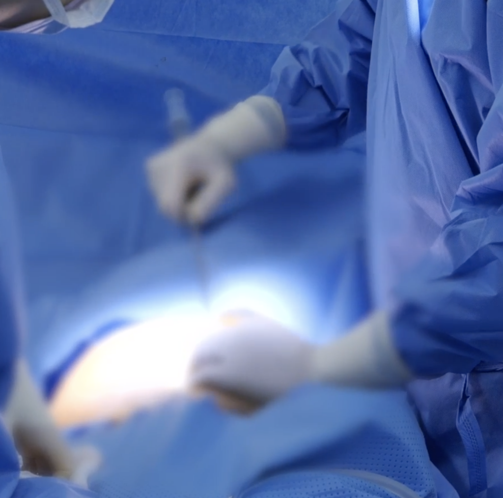 Platform – Organ Regeneration Platform